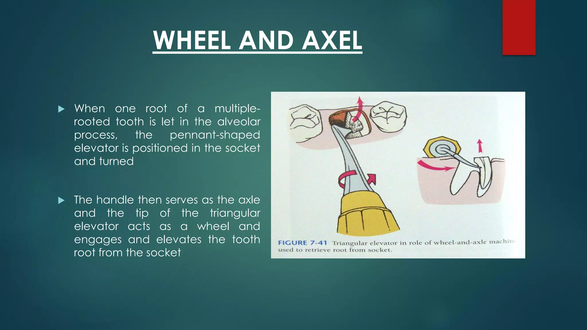 Exodontia Principles and Techniques | PDF