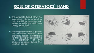 Exodontia Principles and Techniques | PDF