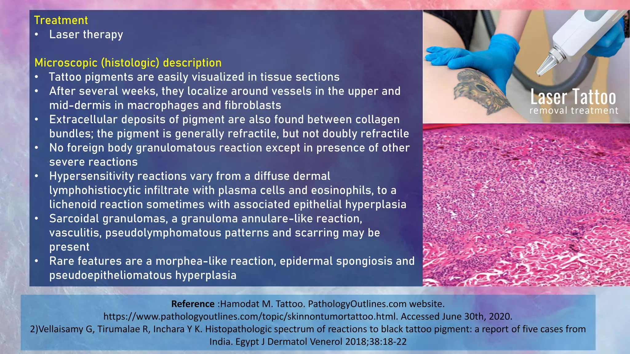 Exogenous Pigmentation of Oral Mucosa | PDF