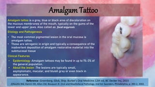 Exogenous Pigmentation of Oral Mucosa | PDF