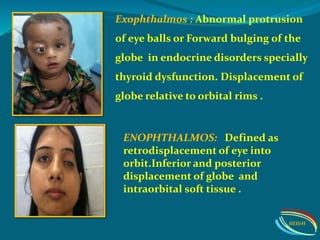 Exophthalmometer | PPTX