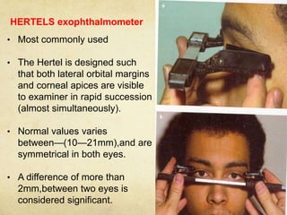 Exophthalmometry | PPTX