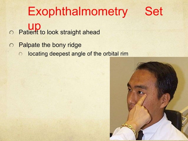 Exophthalmometry | PPTX | Ear, Nose and Throat Conditions | Diseases ...