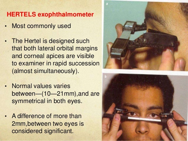 Exophthalmometry