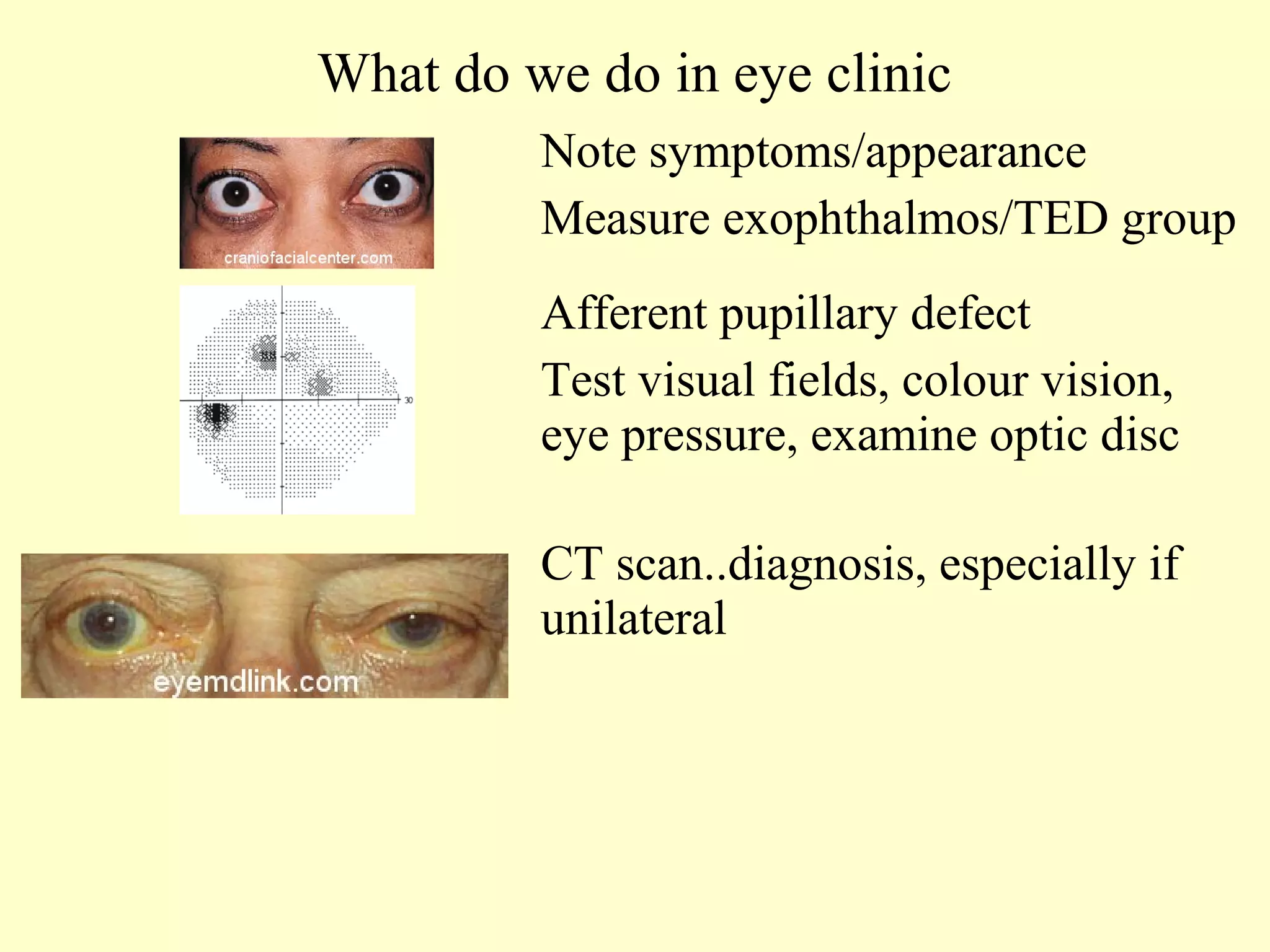 Exophthalmos, thyroid eye disease. | PPT | Thyroid Disorders ...