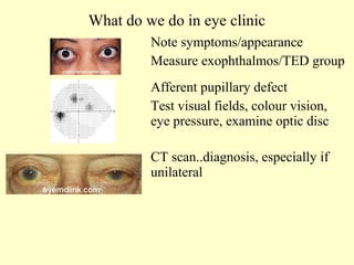 Exophthalmos, thyroid eye disease. | PPT