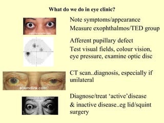 Exophthalmos, thyroid eye disease. | PPT | Thyroid Disorders | Endocrine and Metabolic Diseases