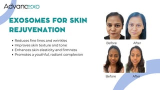 Exosomes in Aesthetics: Revolutionary Treatments for Hair & Skin ...