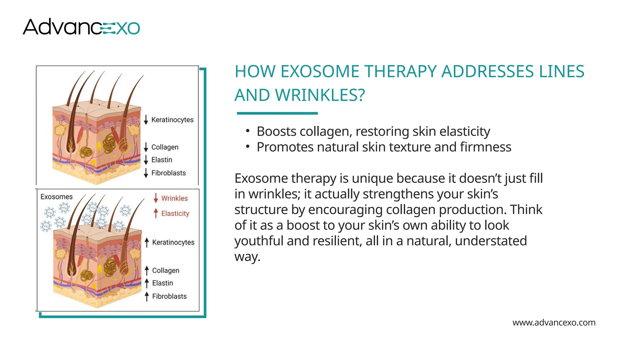 Exosome Therapy for Acne Scars, Lines, and Wrinkles | PPTX