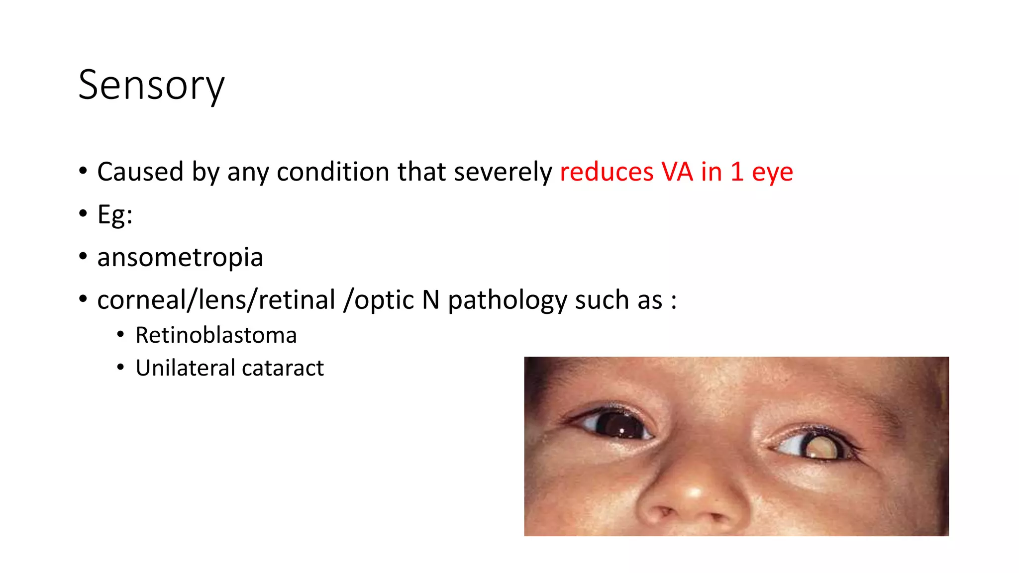 Exotropia | PPTX