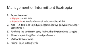 Exotropia | PPTX