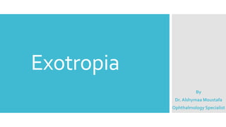 Exotropia | PPTX