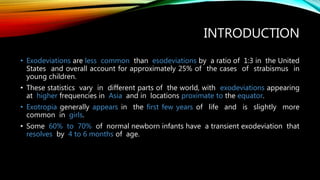 Exotropia cases | PPT