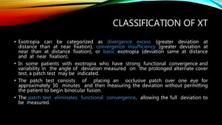 Exotropia cases | PPT