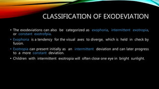 Exotropia cases | PPT
