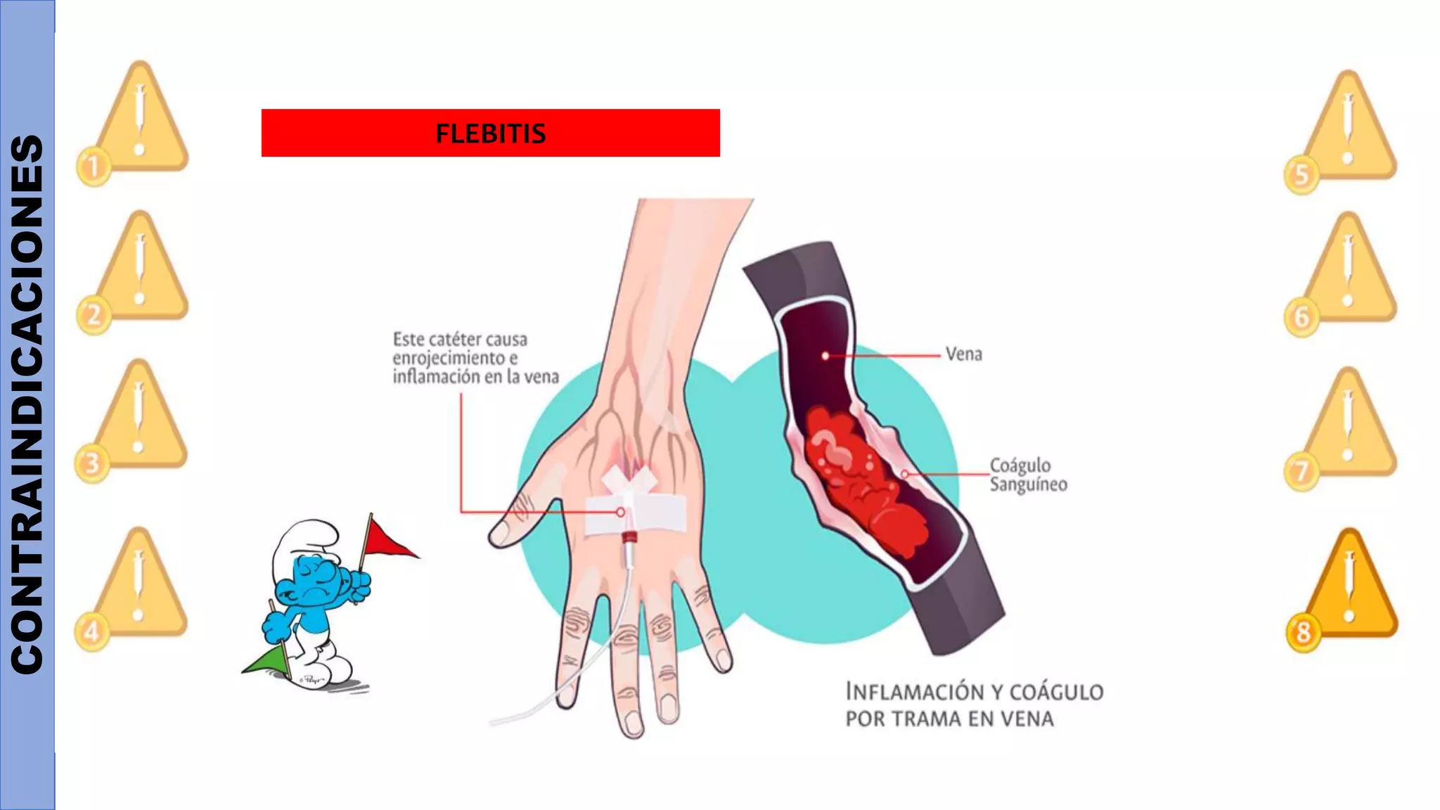 VENOCLISIS | PPTX