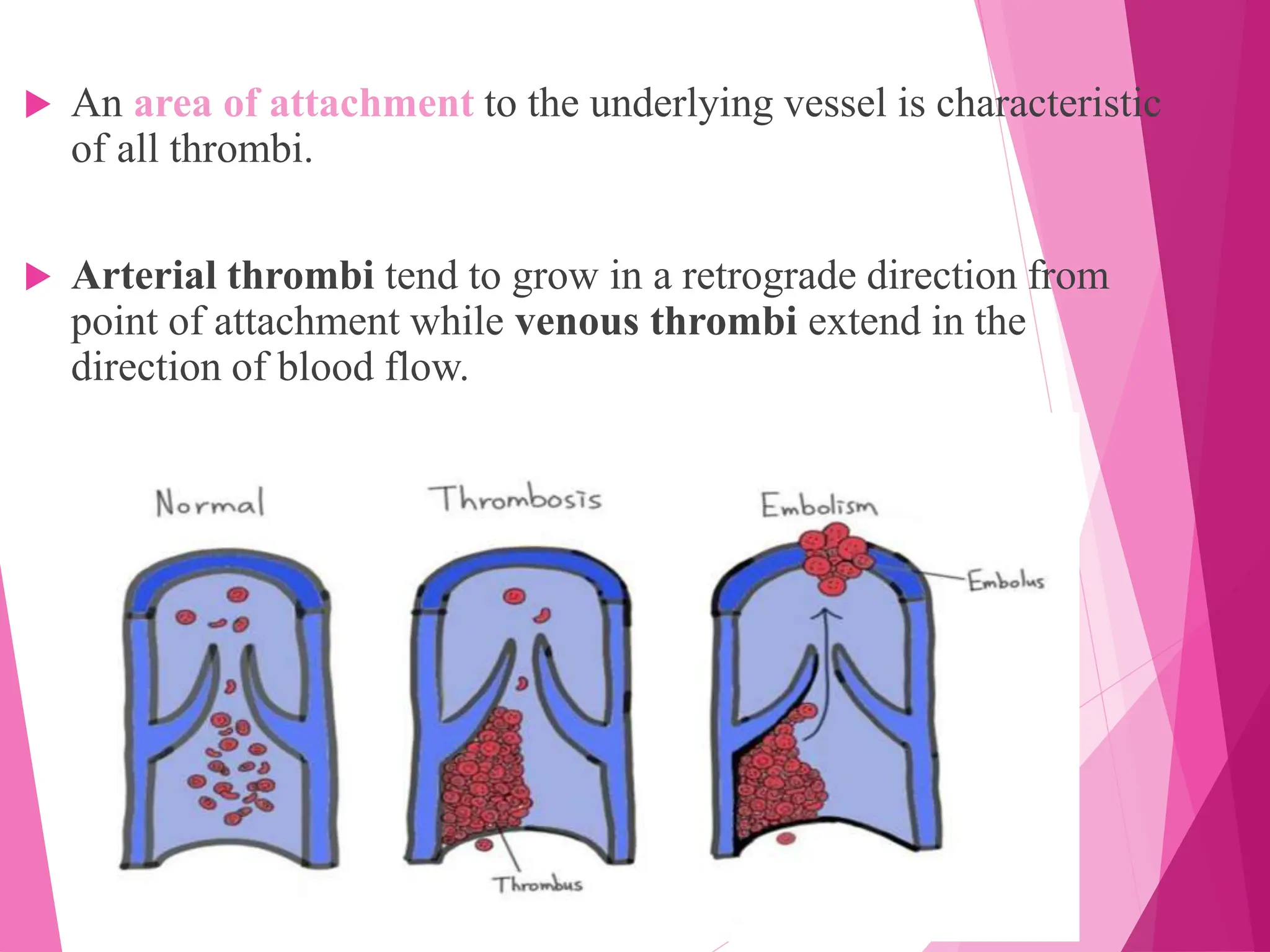 Thrombosis presentation - Pathology.ppt