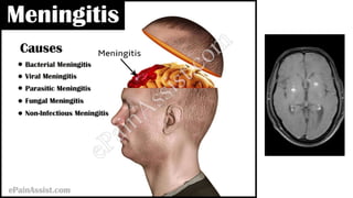 Lumbar Puncher | PPTX