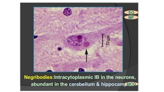 Demonstration of viral inclusion bodies | PPTX