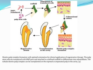 Expanding therapeutic boundaries: Regenerative Endodontics | PPTX