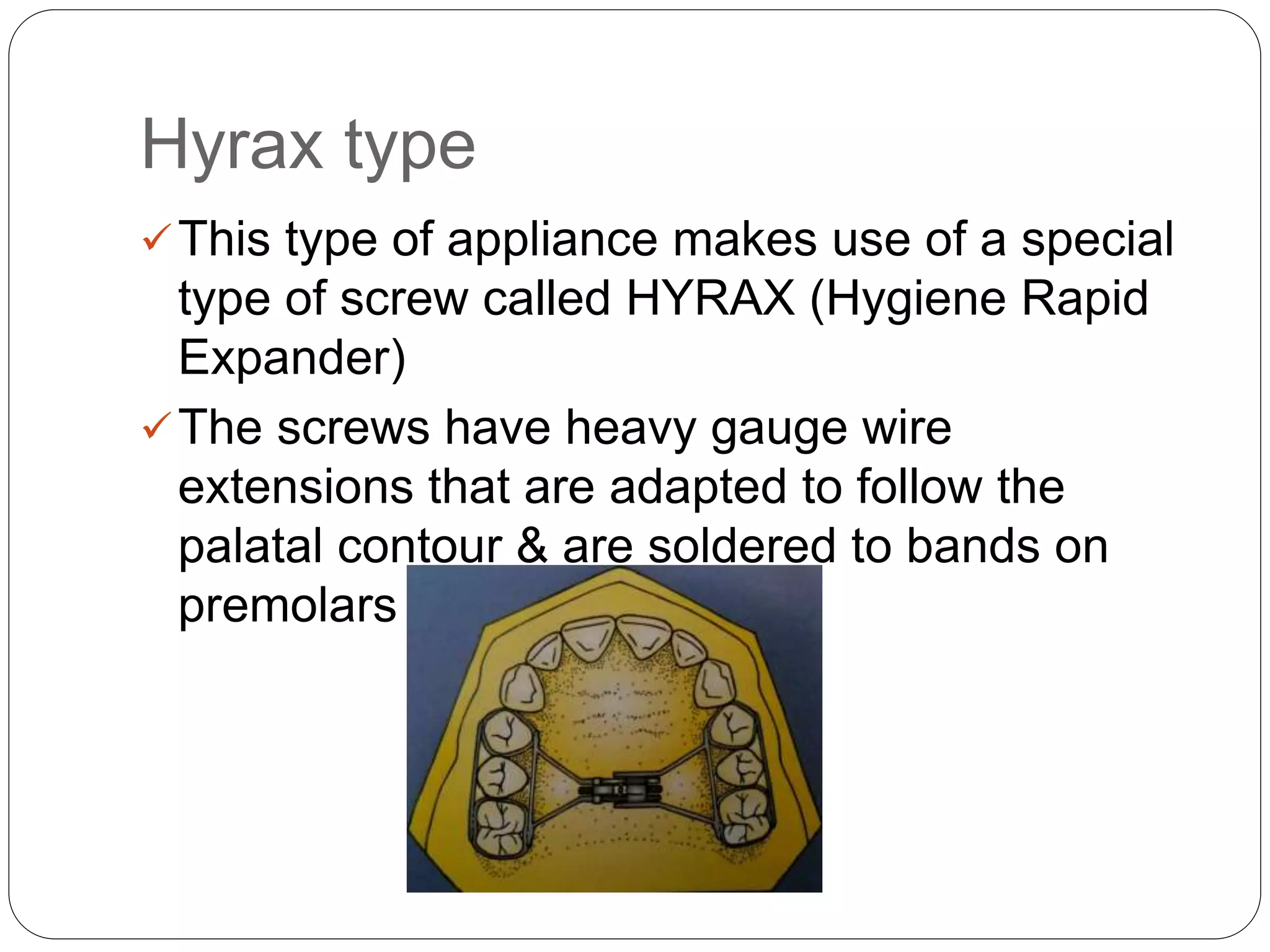 Expansion in orthodontics | PPTX