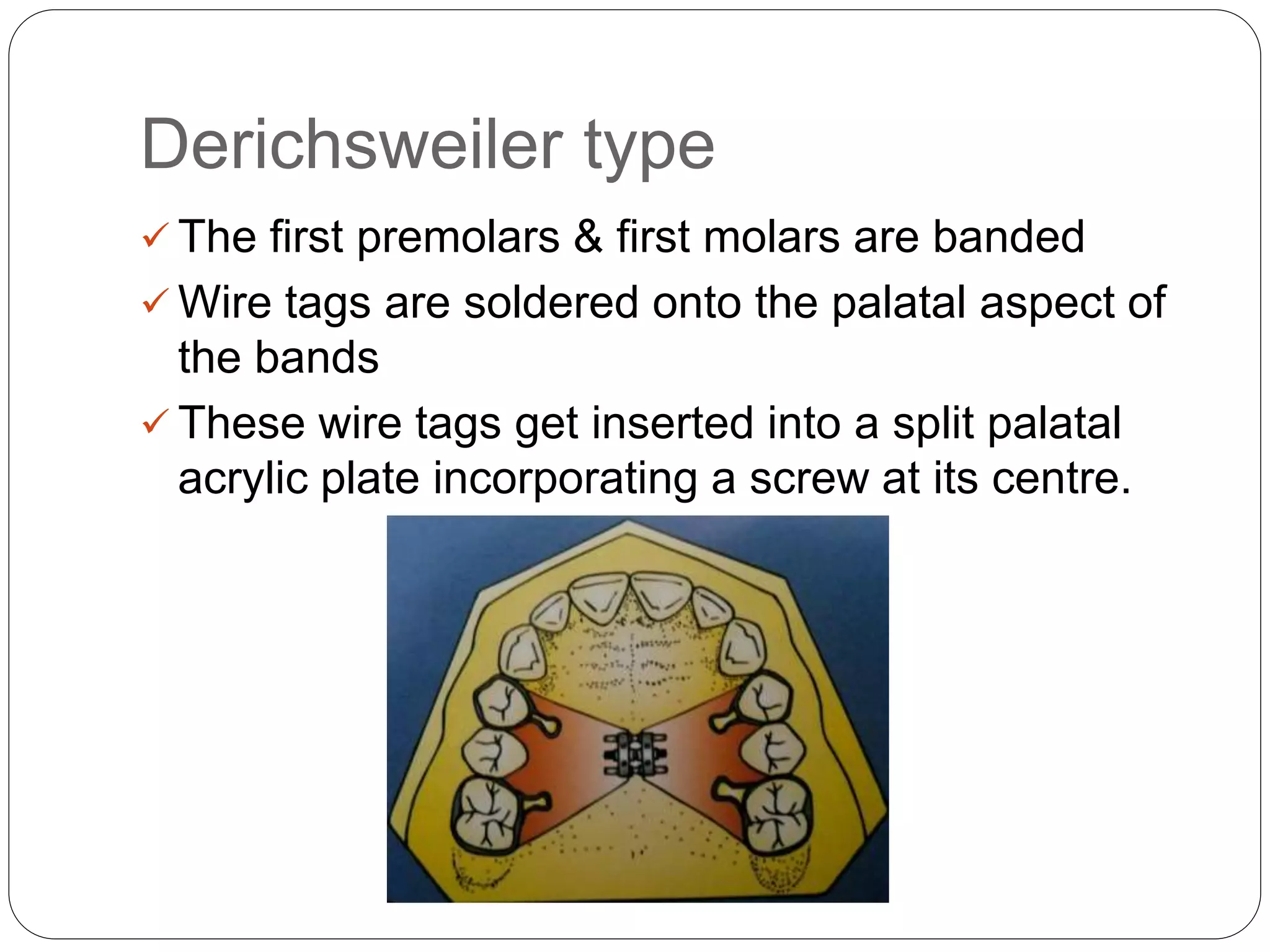 Expansion in orthodontics | PPTX