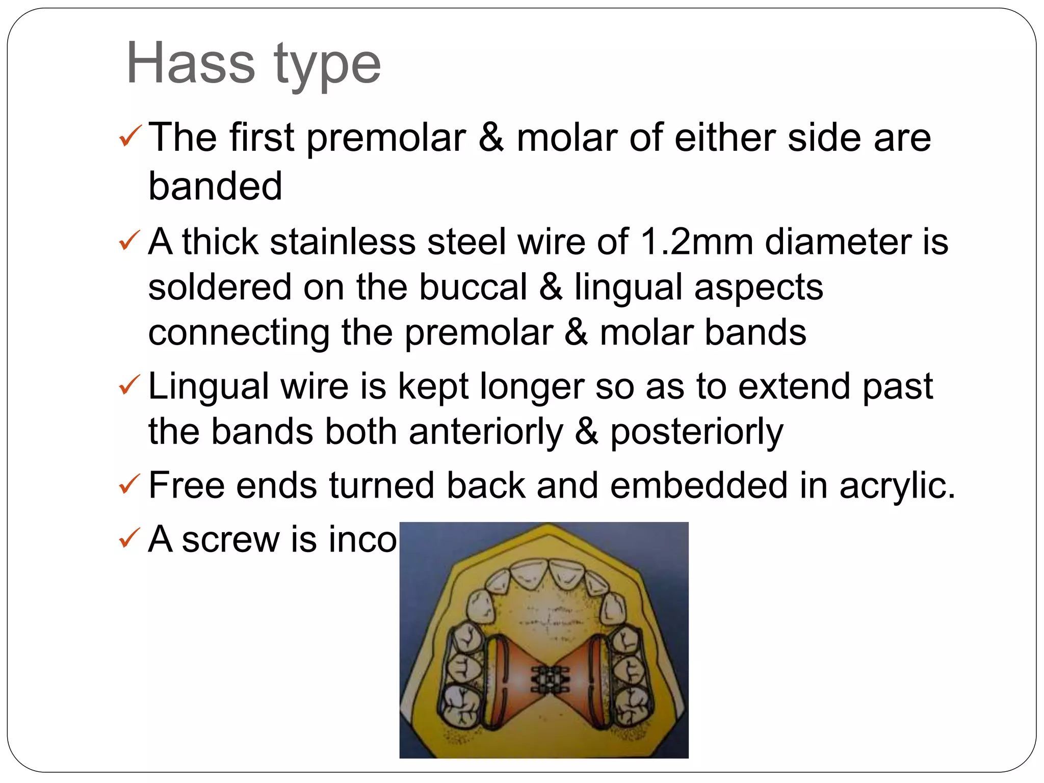 Expansion in orthodontics | PPTX