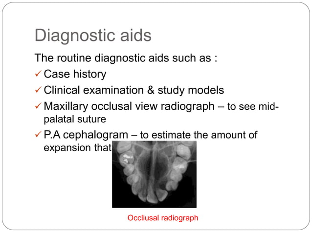 Expansion in orthodontics | PPTX | Dental Health | Diseases and Conditions
