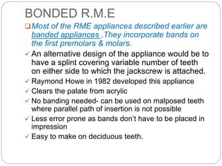 Expansion in orthodontics | PPTX