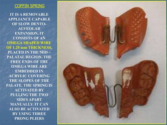 Expansion in orthodontics | PPT | Ear, Nose and Throat Conditions ...