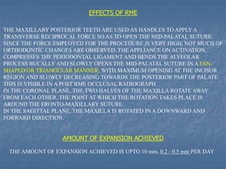 Expansion in orthodontics | PPT