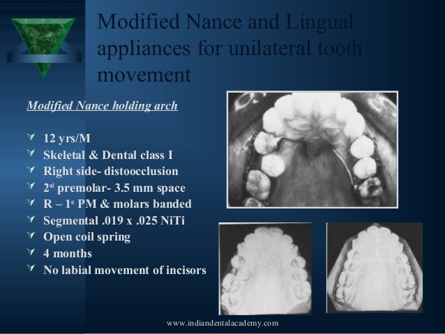 Expansion in orthodontics (2)