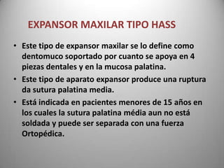 Expansores maxilares | PPTX