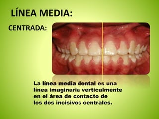 Exploracion Bucal | PPT