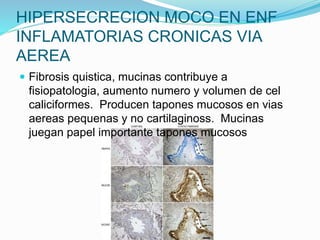 Estudio de Expectoracion | PPTX