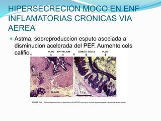 Estudio de Expectoracion | PPTX