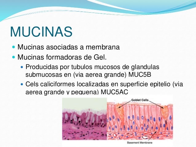 Estudio de Expectoracion