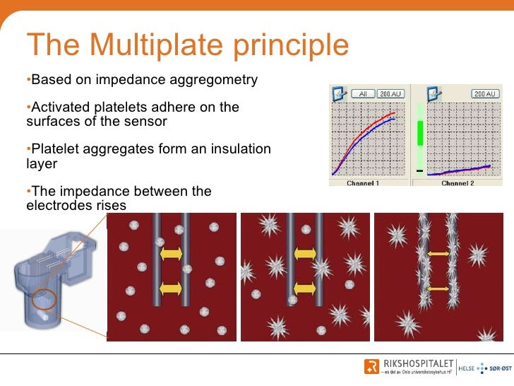 Experiences With The Multiplate