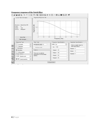 Low pass digital filter using FIR structure of 2nd order | PDF