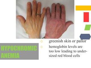 Physiology of Skin and Skeletal system | PPTX