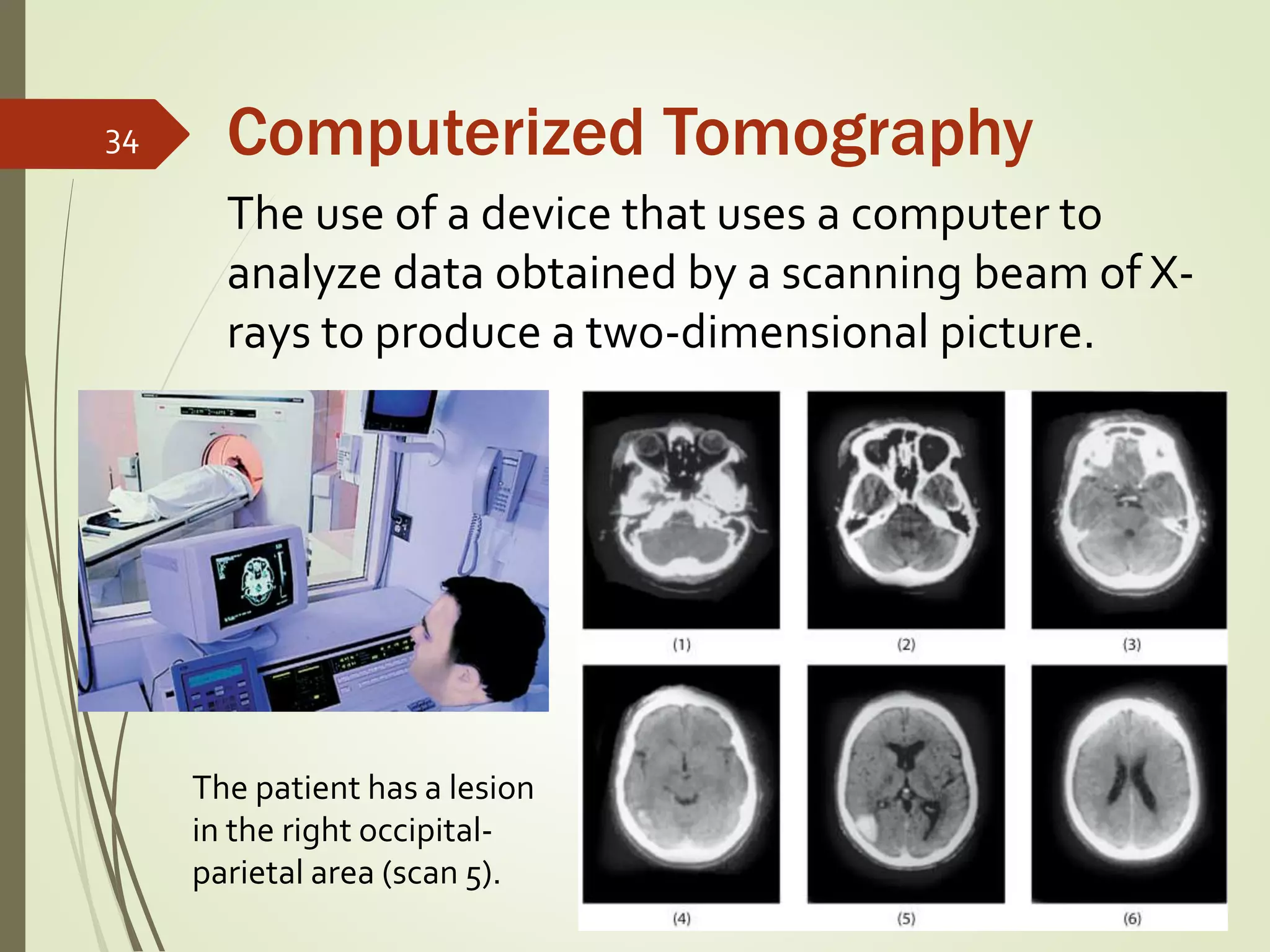 Experimental Ablation | PPTX