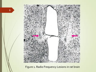 Experimental Ablation | PPTX