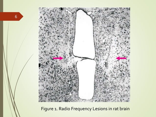 Experimental Ablation | PPTX