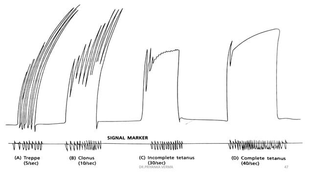 EXPERIMENTAL PHYSIOLOGY NERVE MUSCLE GRAPH.pdf