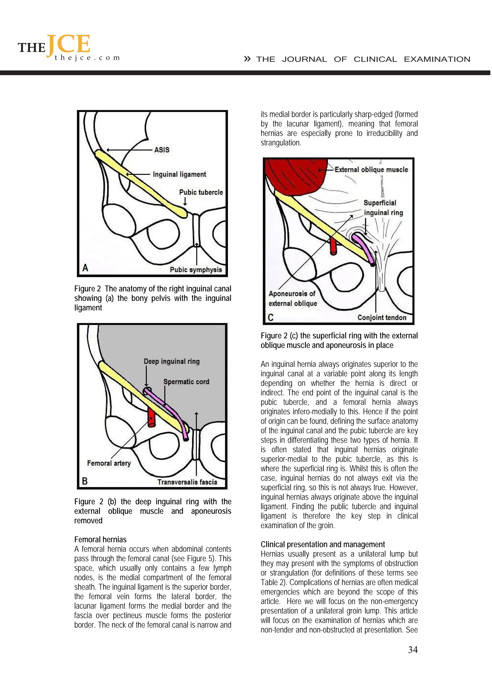 expert-review-examination-of-groin-hernias.pdf