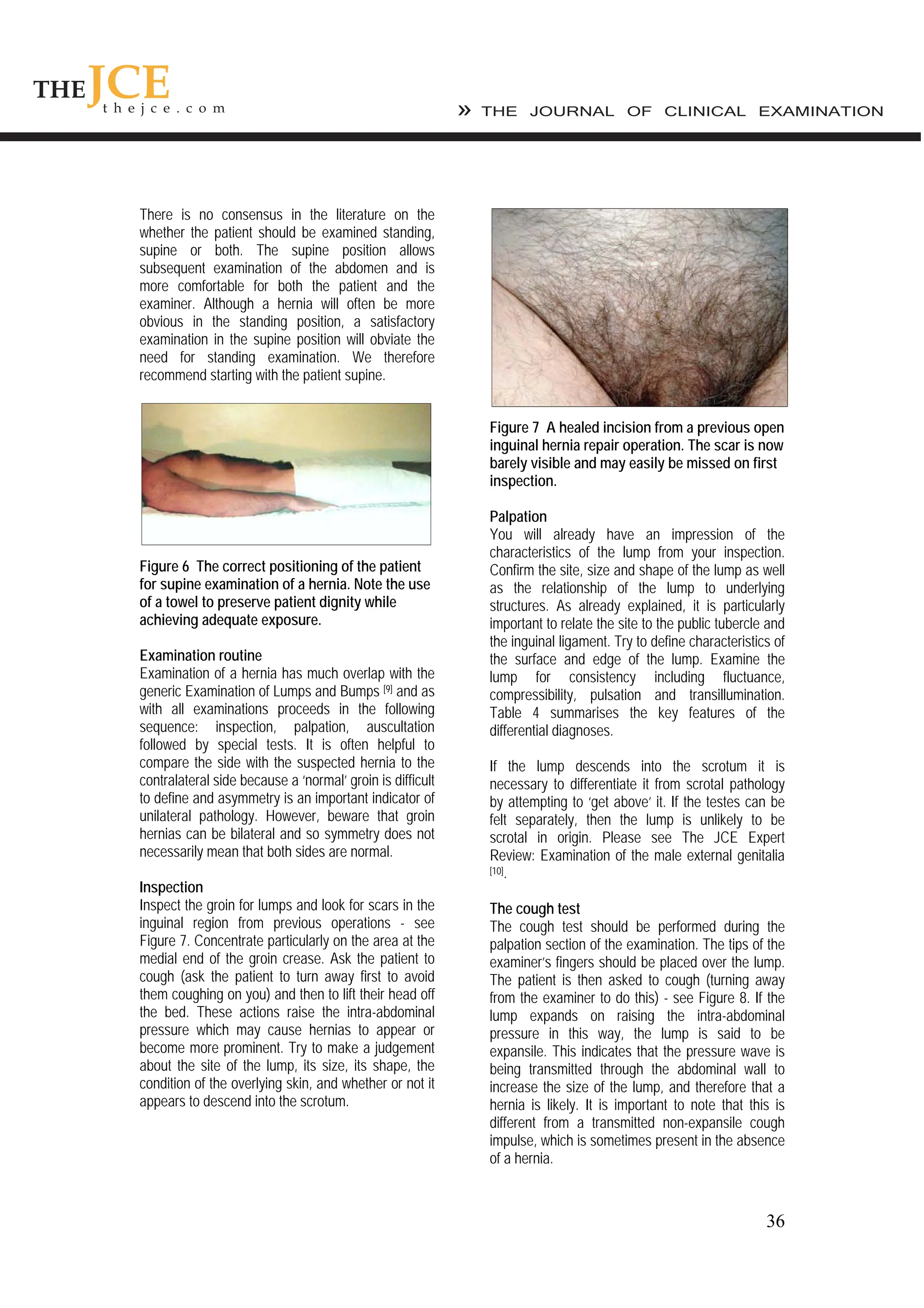 expert-review-examination-of-groin-hernias.pdf