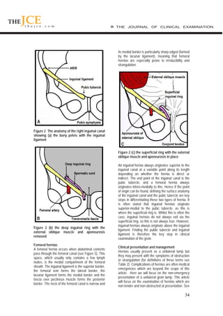 expert-review-examination-of-groin-hernias.pdf