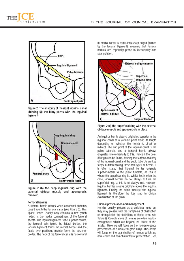 expert-review-examination-of-groin-hernias.pdf