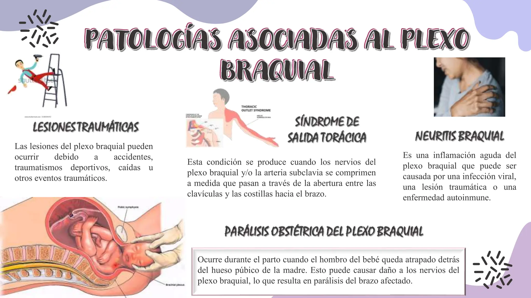 NEURLOGIA DEL PLEXO BRAQUIAL SU FUNCION Y ANATOMIA | PPT
