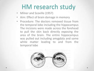 Explain how biological factors may affect one Cognitive process. | PPTX